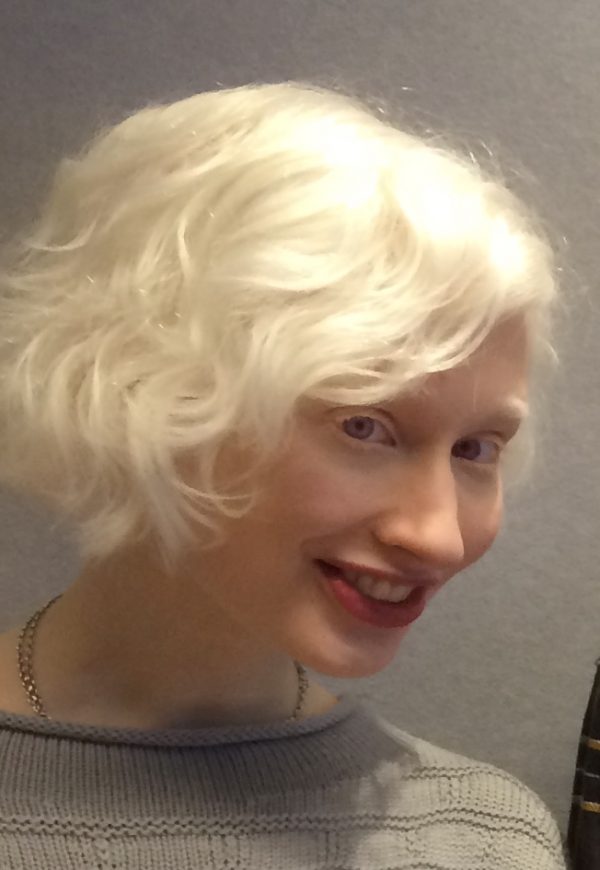 About Albinism – Albinism Fellowship of Australia